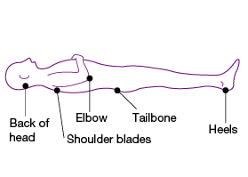 South Metropolitan Health Service - Preventing pressure injuries